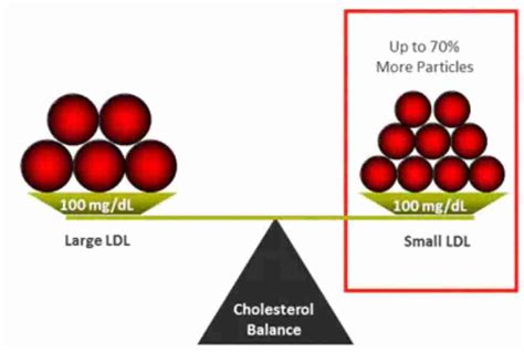 Advanced Lipid Testing Ifn Academy
