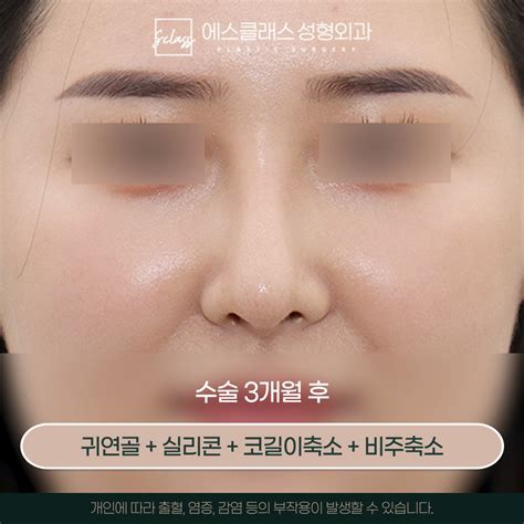 부산 서면 에스클래스성형외과의원