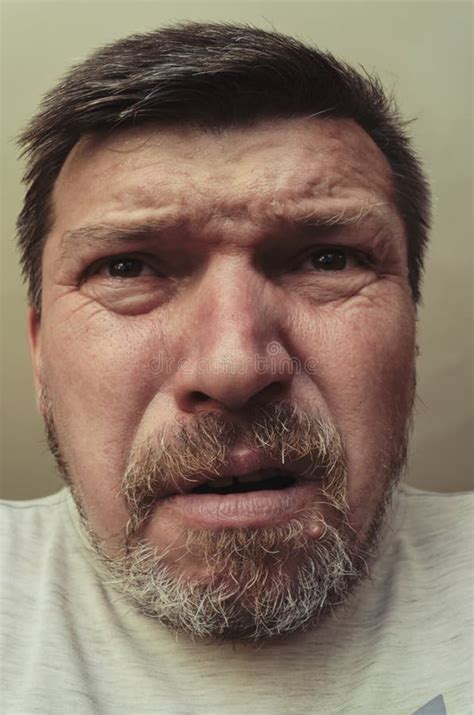 Unusual Bearded Albino Man With White Hair And Pale Skin Standing Over
