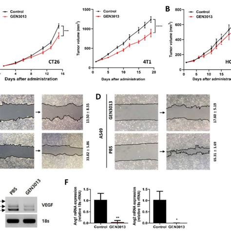 Lactococcus Lactis Gen3013 Treatment Prevents Tumor Growth Through