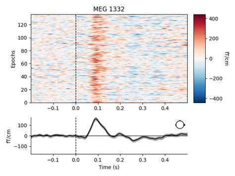 Overview Of Megeeg Analysis With Mne Python — Mne 111 Documentation