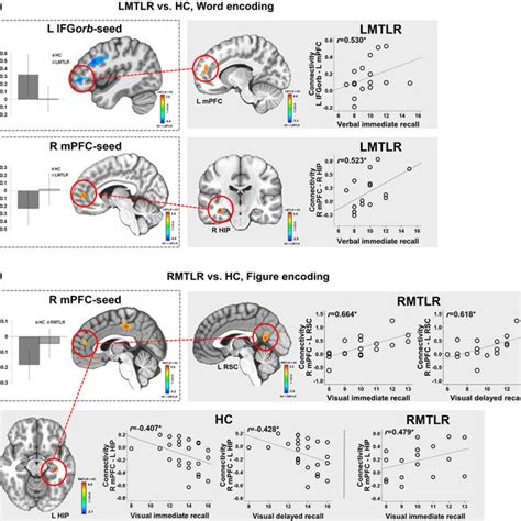 A Proposed Functional Organization Of The Medial Temporal Lobe Memory Download Scientific