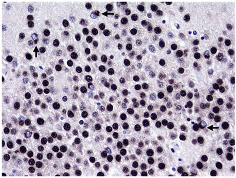 Sparse To Moderate Numbers Of Ncis Arrows In The Dentate Gyrus Download Scientific Diagram