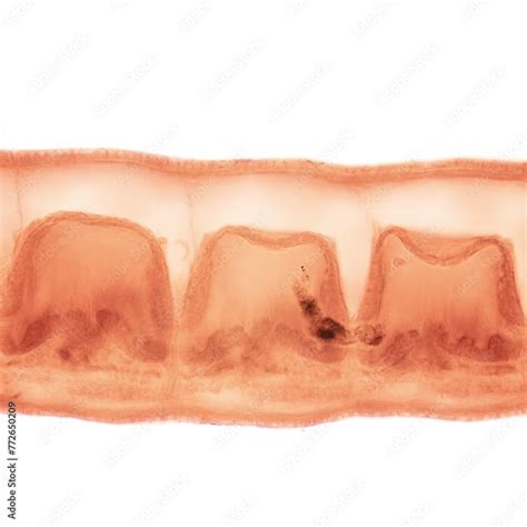 Schistosoma Japonicum Is A Parasite That Causes Human Schistosomiasis And Is Mainly Prevalent