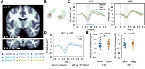 Figure 2 From Rapid Processing Of Invisible Fearful Faces In The Human Amygdala Semantic Scholar