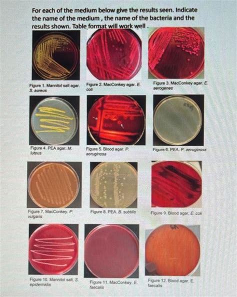 Enterococcus Faecalis Macconkey Agar