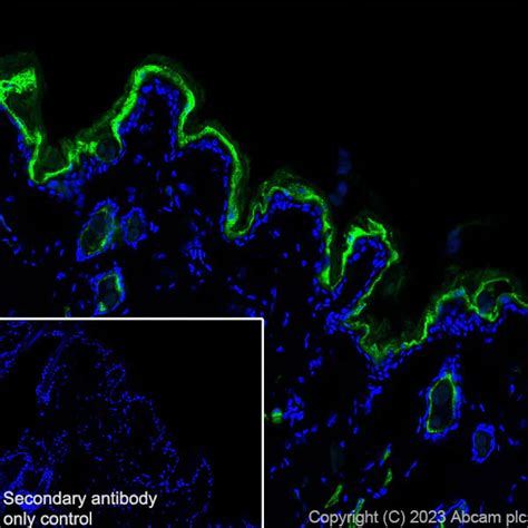 Anti Loricrin Antibody Rm1090 Ab315352 Abcam