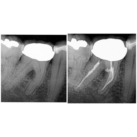 Triton Brasselerusa Brasselerbyyourside Byyourside Saveyourtooth Brasseler Usa