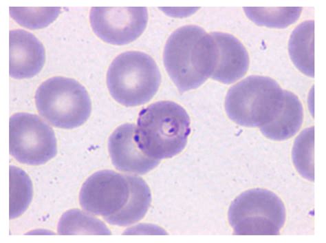What Does Malaria Look Like Under A Microscope