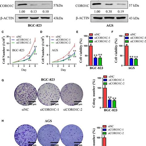 Coro1c Promoted Cell Proliferation Of Human Gastric Cancer Cells