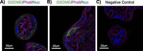 Loss Of Polarity Regulators Initiates Gasdermin E Mediated Pyroptosis
