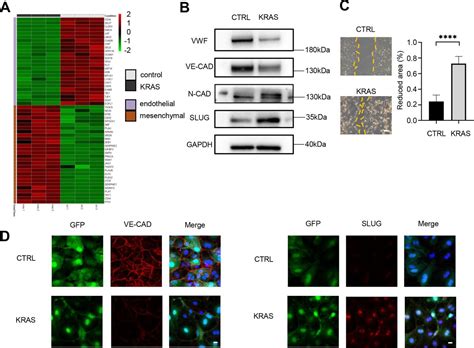 Kras Mutation Induced Endmt Of Brain Arteriovenous Malformation Is Mediated Through The Tgf β