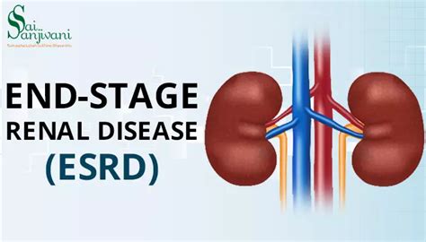 End Stage Renal Disease Esrd Symptoms And Causes Sai Sanjivani
