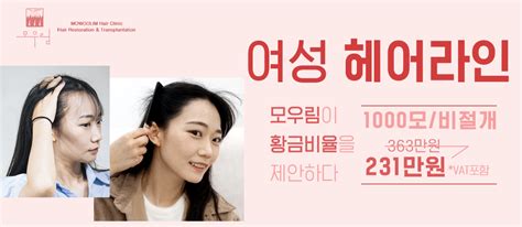 얼굴축소 여성 헤어라인 모발이식 모두닥