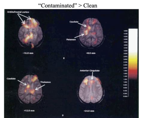 Behavioral Neuroscience Exam 3 Review Flashcards Quizlet