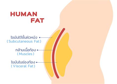 ไขมันช่องท้อง Visceral Fat เกิดจากอะไร มีวิธีลดและป้องกัน อย่างไร
