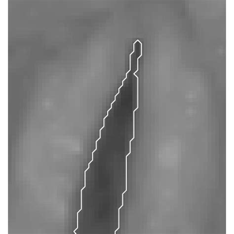 Case 3 Segmented Hsv Image Sequence By The Method Of 7 A The Download Scientific Diagram