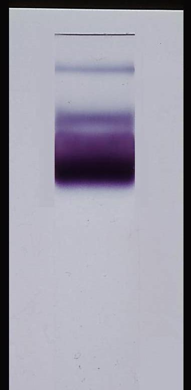 Gel Electrophoresis Wikipedia