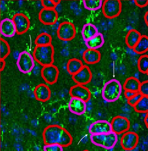 Object Classifier Not Including Cells Of Interest Image Analysis Image Sc Forum