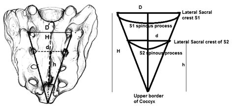 Caudal Anesthesia Technique