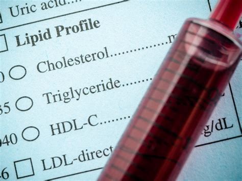 Fast Five Quiz Hypertriglyceridemia Page 3 Fast Five Quiz Hypertriglyceridemia Page 3