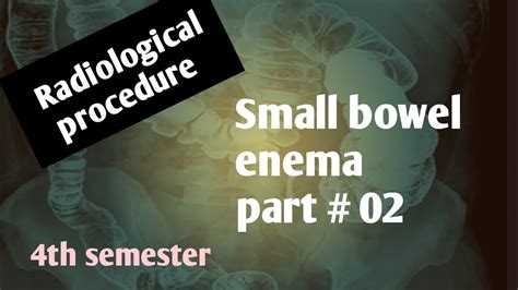 Small Bowel Enemapart02patient Preparationtechniqueprocedure