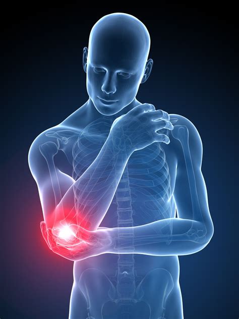 Lateral Epicondylitis Tennis Elbow