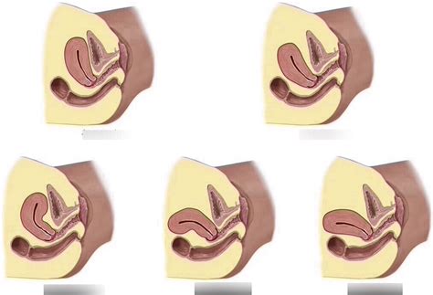 Uterus Positions Diagram Quizlet