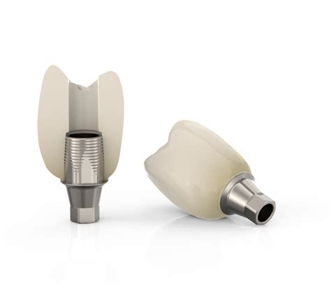 Scan Body Compatible With Mis® Internal Standard 35