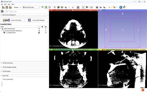 Bug 521 Data Is Loaded From Database But Doesnt Appear Under
