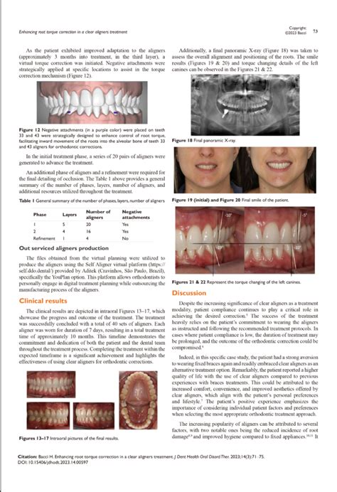 Enhancing Root Torque Correction In A Clear Aligners Treatment