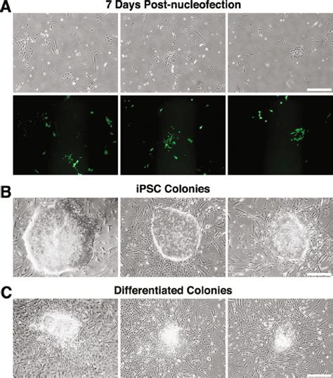 Reprogramming Of Human Fibroblasts On Vitronectin Coated Dishes In