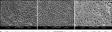 Figure 1 From Influence Of Apical Preparation Size On Effective Conventional Irrigation In The
