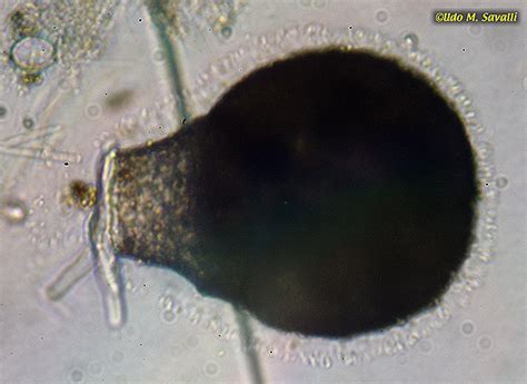 Bio385 Protozoa