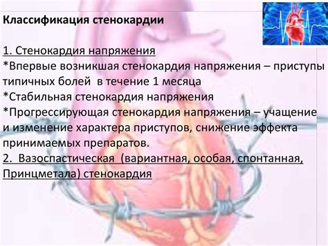Стенокардия презентация онлайн