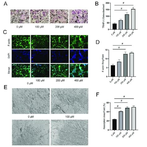 Pdf Trimethylamine N Oxide Promotes Osteoclast Differentiation And