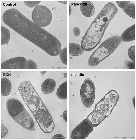 Transmission Electron Microscopic Micrographs Of E Coli Treated With