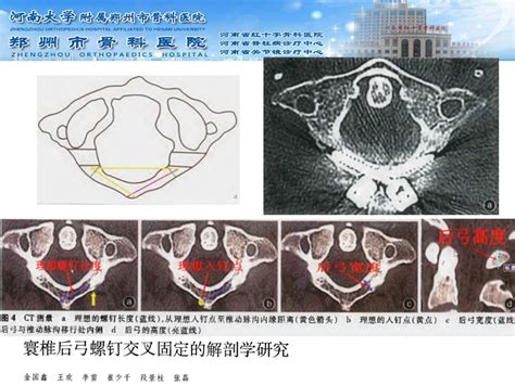 文章详情