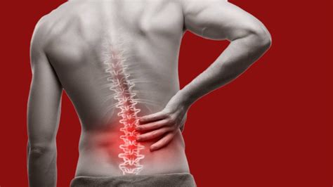 Can Pinched Nerve Cause Sexual Dysfunction Clearance