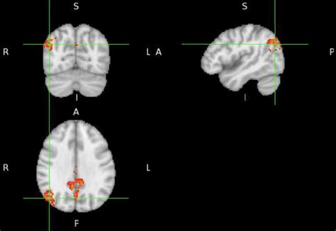 Functional Connectivity Analysis Of Resting State FMRI Data Using FSL MRI On BEAR