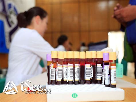 Өнгөрсөн сард манай улсад ХДХВ ДОХ ын хоёр тохиолдол бүртгэгджээ Isee Mn