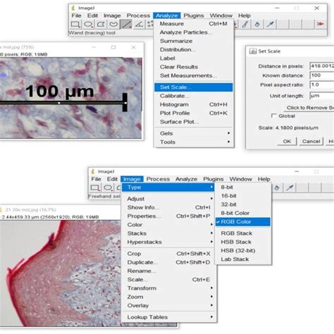 Steps For Performing Collagen Quantification In Imagej The Scale Has Download Scientific