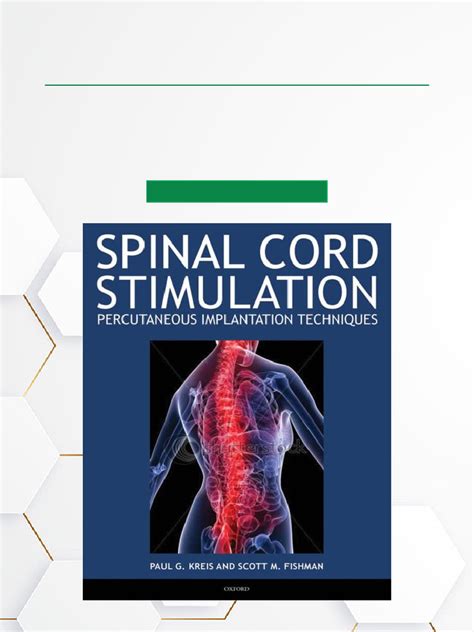 Most Wanted Spinal Cord Stimulation Percutaneous Implantation