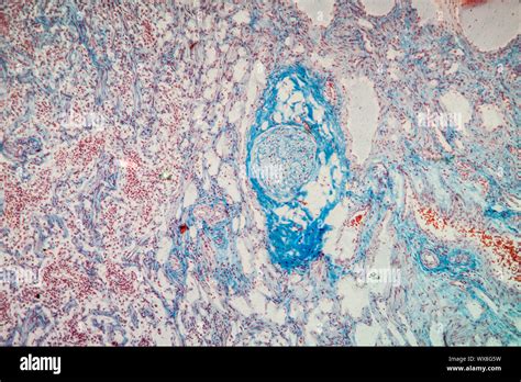 Lymph Node Tissue Under The Microscope 100x Stock Photo Alamy