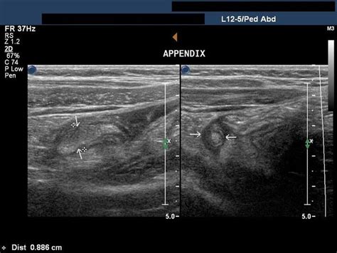 A Gallery Of High Resolution Ultrasound Color Doppler And 3d Images