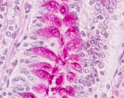 Culture Duodenal Tissue