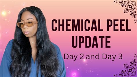 Chemical Peel Update Vlog Days 2 And 3 Chemicalpeel Skincareroutine