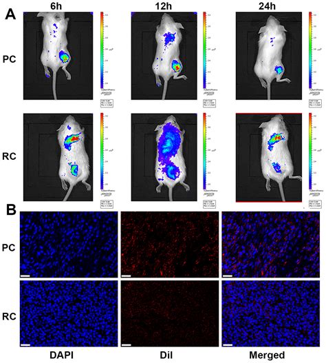 Copper Based Single Atom Nanozyme For Radioimmunotherapy Ijn