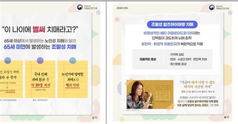 젊은 세대도 이젠 안심할 수 없다 조발성 치매 증가