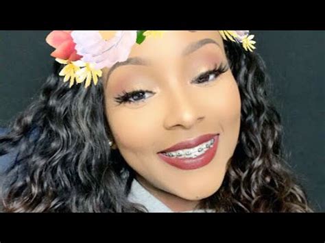 VLOG Braces Update YouTube VLOG Braces Update YouTube